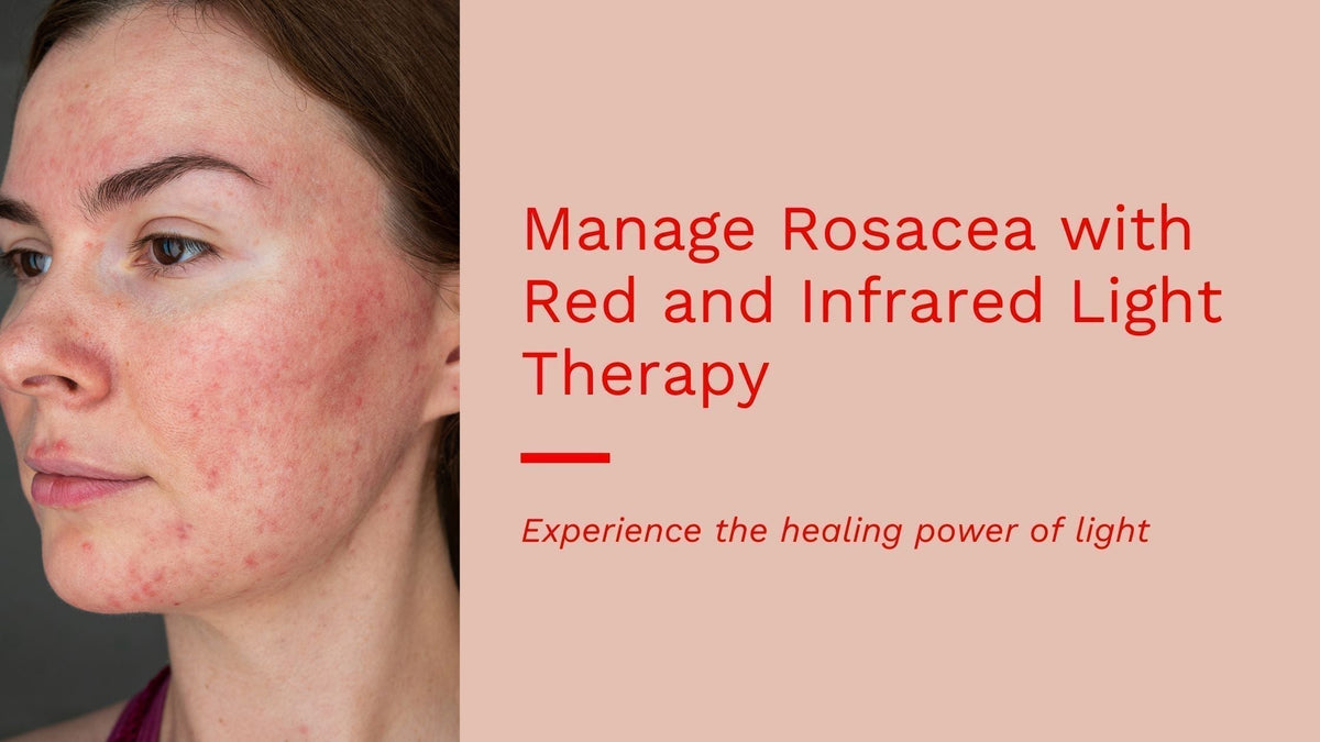 Red and Infrared Light Therapy for Rosacea – Infrared Lights NZ
